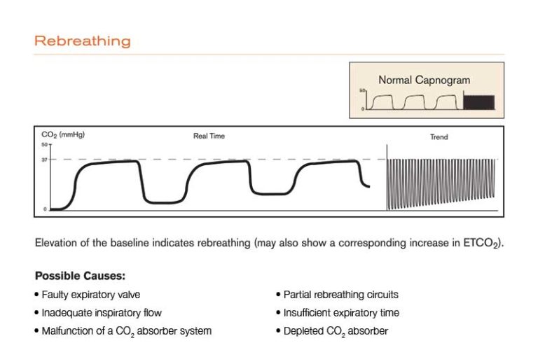 Understanding capnography and anesthesia – Veterinary Practice News