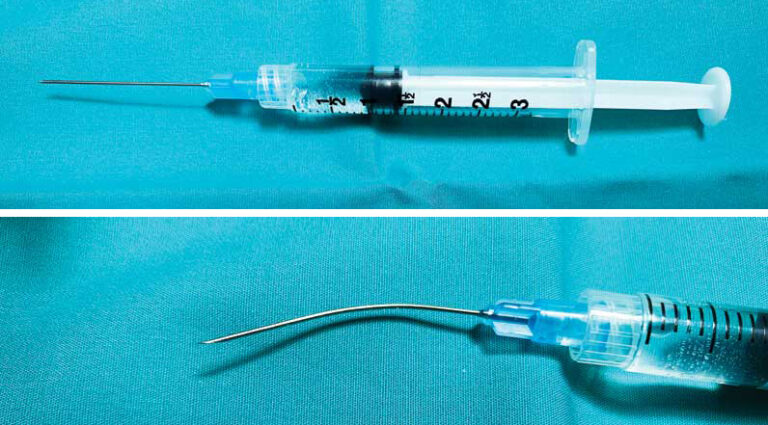 A look at analgesia for enucleation