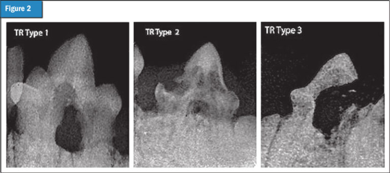 Diagnosing tooth resorption in cats and dogs