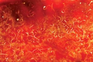 Hookworms are becoming resistant to treatment—what now?