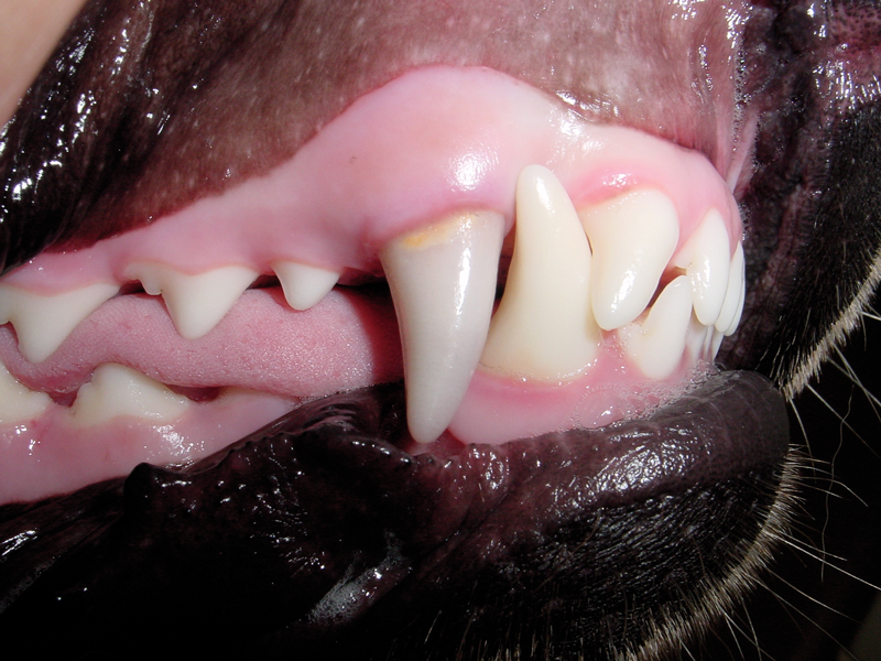 Why You Should Keep Pulpitis in Mind When Treating A Discolored Tooth ...