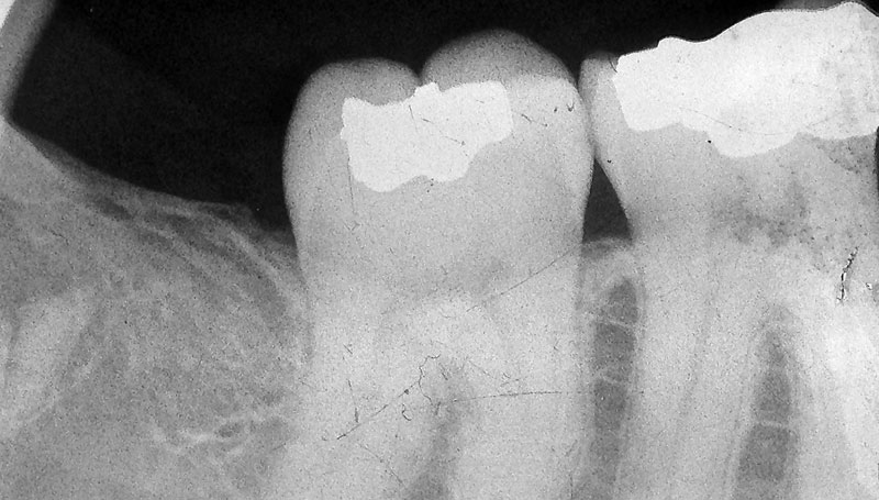 How to Remove Stubborn Tooth Roots - Veterinary Practice News
